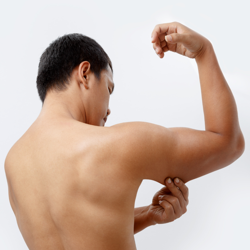 Cellutrix (mesoterapia corporal) – Clínica MBA